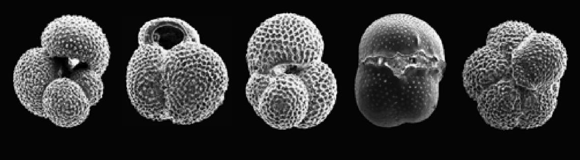 foraminifera microscope